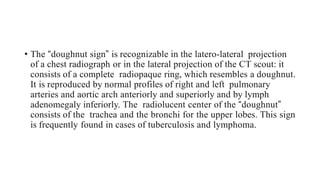 IMAGE OF THE WEEK...pptx | Lung and Respiratory Health | Diseases and ...