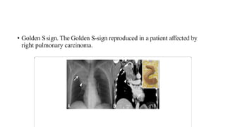IMAGE OF THE WEEK...pptx | Lung and Respiratory Health | Diseases and ...