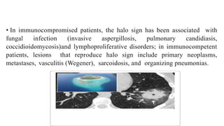 IMAGE OF THE WEEK...pptx | Lung and Respiratory Health | Diseases and ...