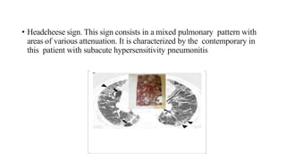 IMAGE OF THE WEEK...pptx | Lung and Respiratory Health | Diseases and ...