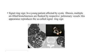 IMAGE OF THE WEEK...pptx | Lung and Respiratory Health | Diseases and ...