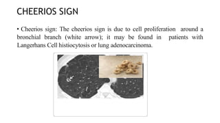 IMAGE OF THE WEEK...pptx | Lung and Respiratory Health | Diseases and ...