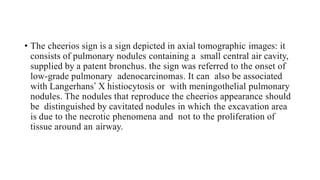 IMAGE OF THE WEEK...pptx | Lung and Respiratory Health | Diseases and ...