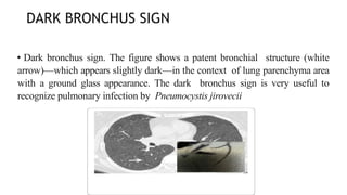 IMAGE OF THE WEEK...pptx | Lung and Respiratory Health | Diseases and ...