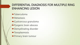 Differential diagnosis for ring enchancing lesion in brain | PPTX