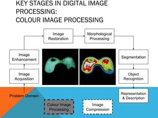 Digital Image Processing | PPT