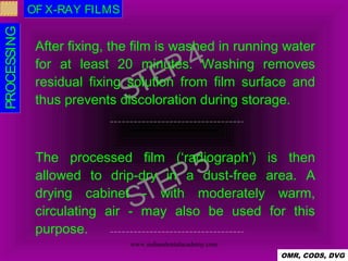 x-ray Image processing | PPT