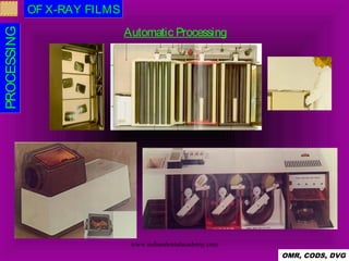 x-ray Image processing | PPT