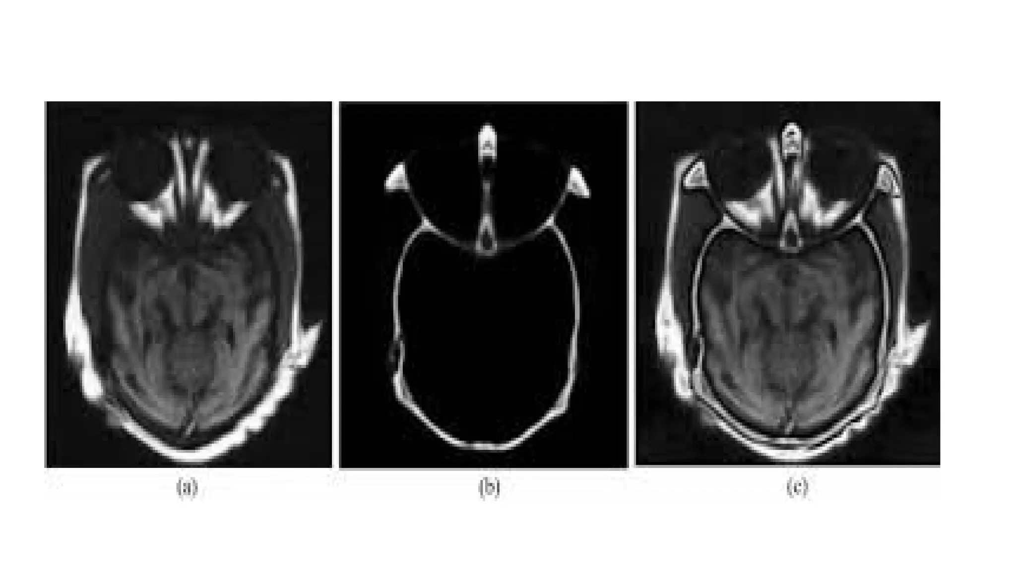 Image Pyramid gaussian pyramid laplacian | PPTX