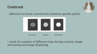 Image Quality - Radiologic Imaging | PPTX