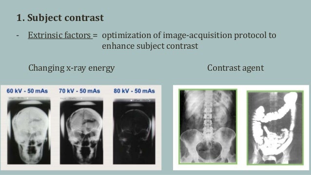Image Quality - Radiologic Imaging