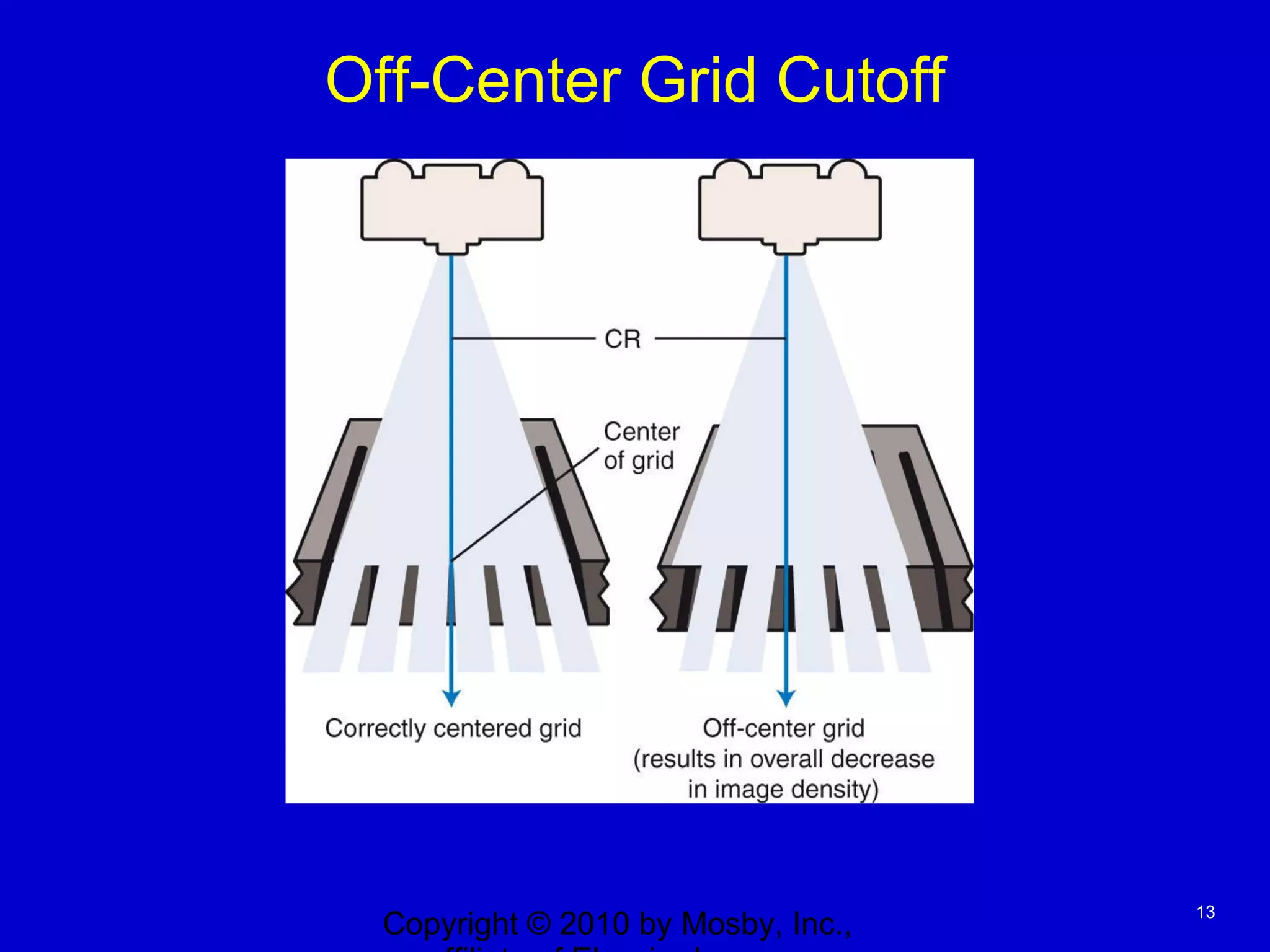 Image quality, digital technology and radiation protection | PPT