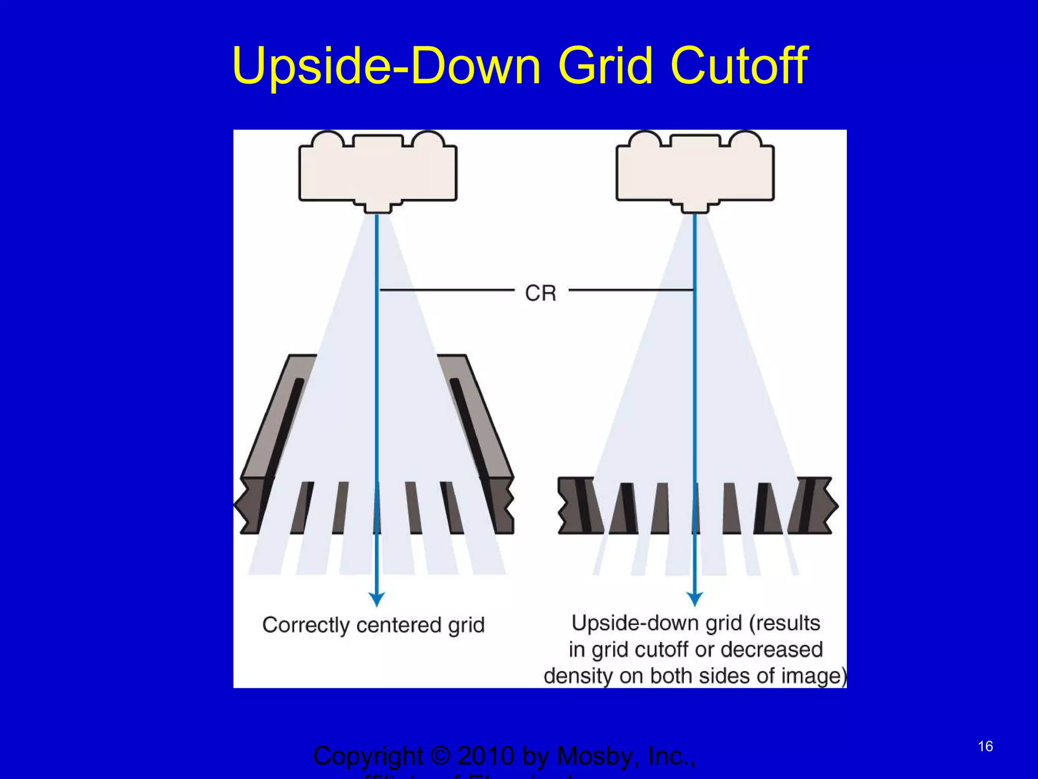 Image quality, digital technology and radiation protection | PPT