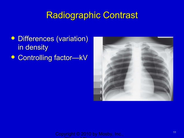 Image quality, digital technology and radiation protection | PPT ...