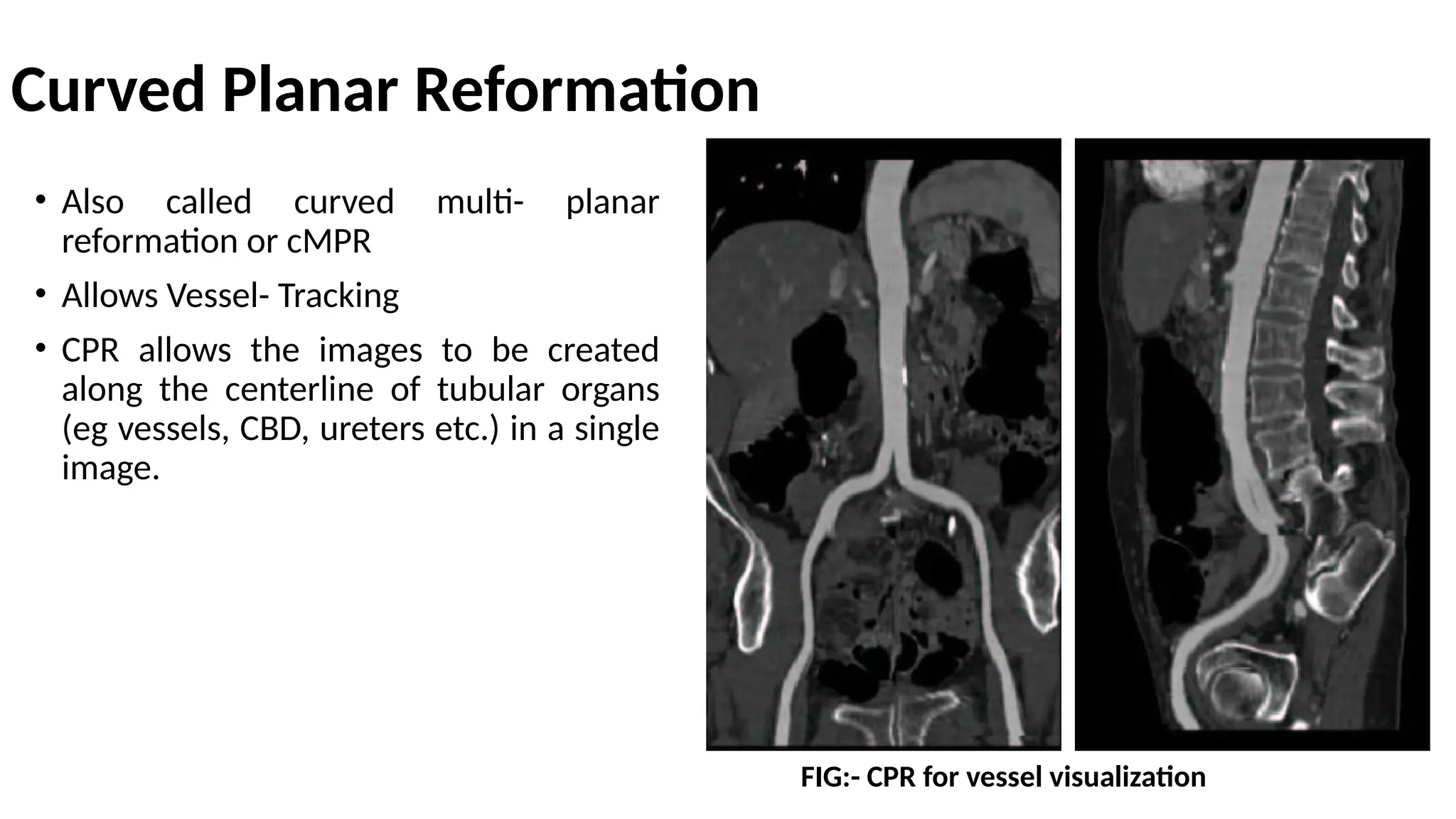 IMAGE REFORMATION TECHNIQUES IN CT-SABBU.pptx