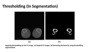 IMAGE REFORMATION TECHNIQUES IN CT-SABBU.pptx | 3-D Graphics | Computer ...