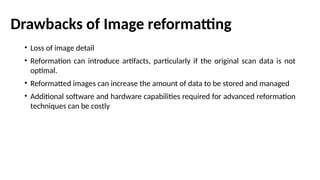 IMAGE REFORMATION TECHNIQUES IN CT-SABBU.pptx | 3-D Graphics | Computer ...