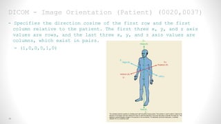 Image registration by using SimpleITK | PPTX