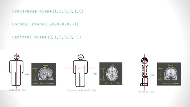 Image registration by using SimpleITK | PPTX