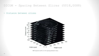 Image registration by using SimpleITK | PPTX