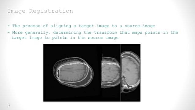 Image registration by using SimpleITK | PPTX