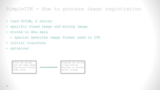 Image registration by using SimpleITK | PPTX