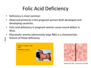 Roles of Vitamins and Minerals in health | PPT