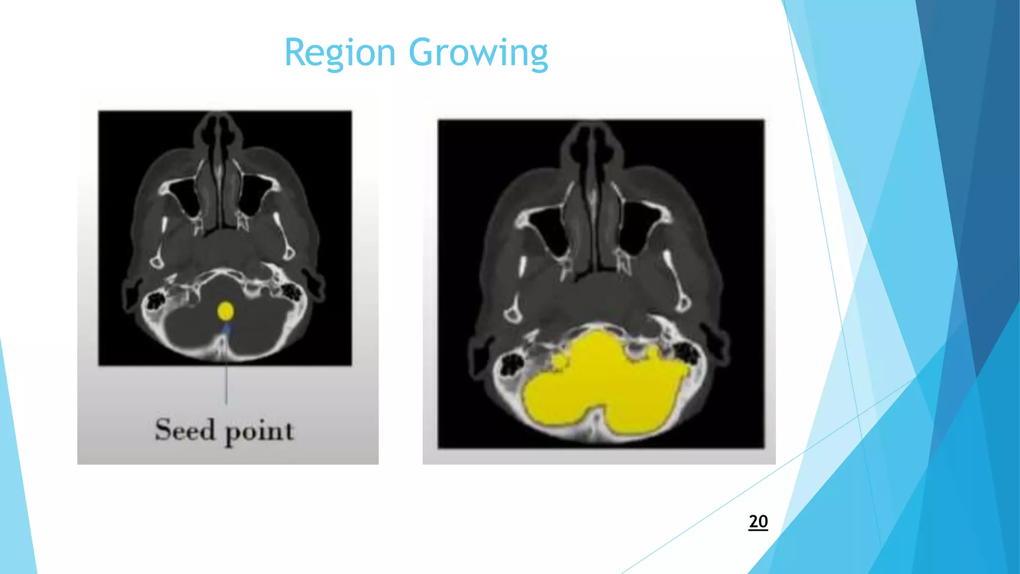 Basic Principles of Image Segmentation in Medical Images.pptx