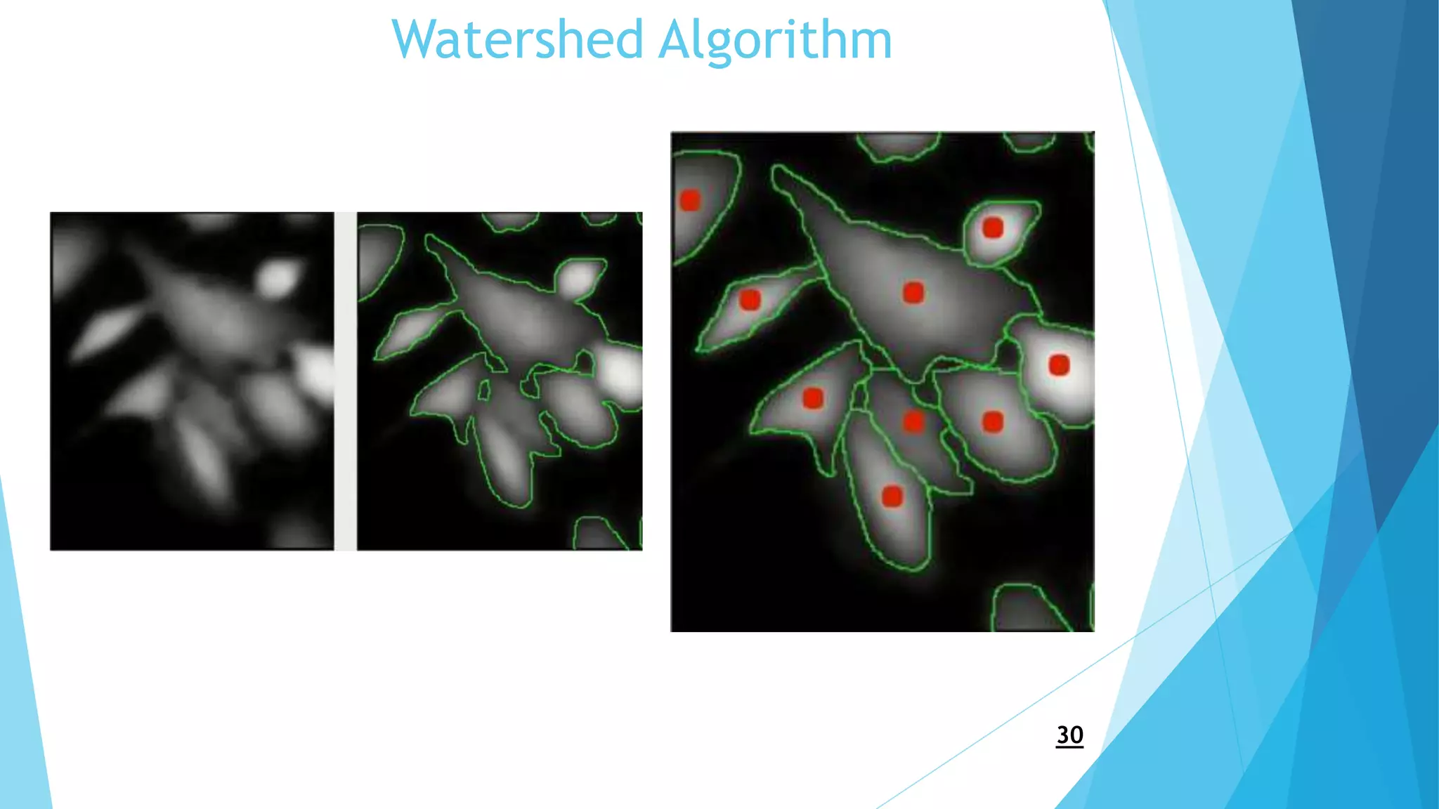 Basic Principles of Image Segmentation in Medical Images.pptx