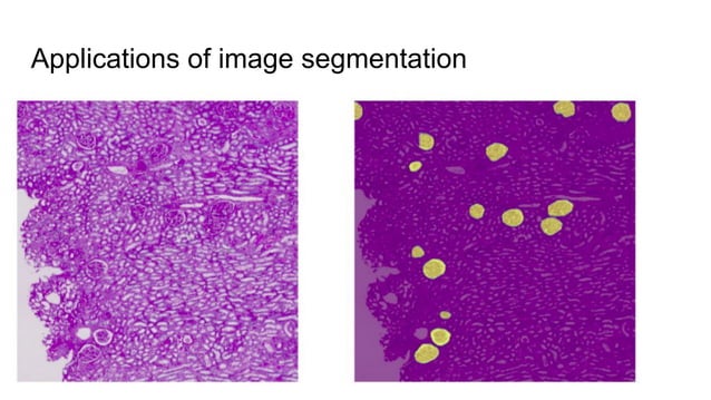 Image segmentation with deep learning | PDF