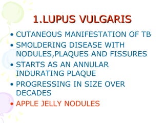 Images: Lupus Vulgaris ... VHL Syndrome | PPT