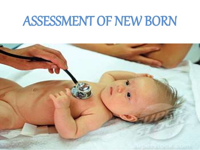 Images ppt new born assessment