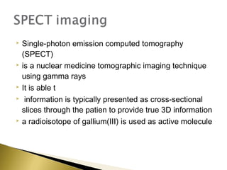 IMAGING TECHNIQUES | PPT
