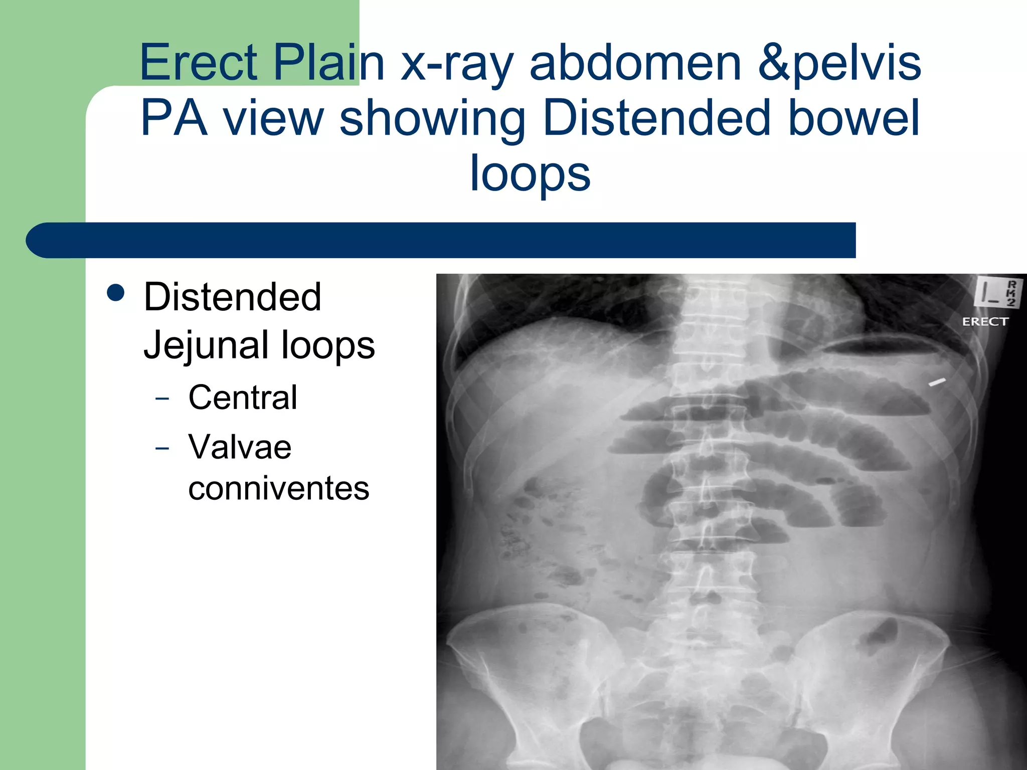 Imaging | PPT