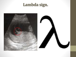 radiology & imaging in OB/GYN | PPTX
