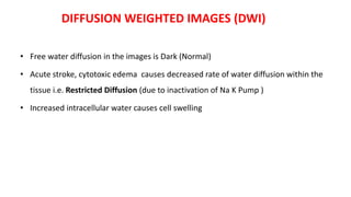 basics of imaging in neurology | PPTX