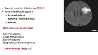 basics of imaging in neurology | PPT