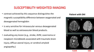 basics of imaging in neurology | PPTX