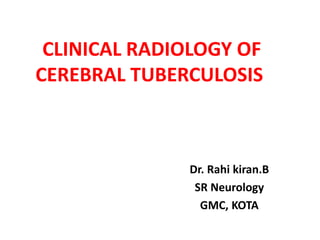 Imaging cns tb | PPTX