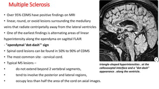 imaging in neurology - demyelinating diseases | PPTX