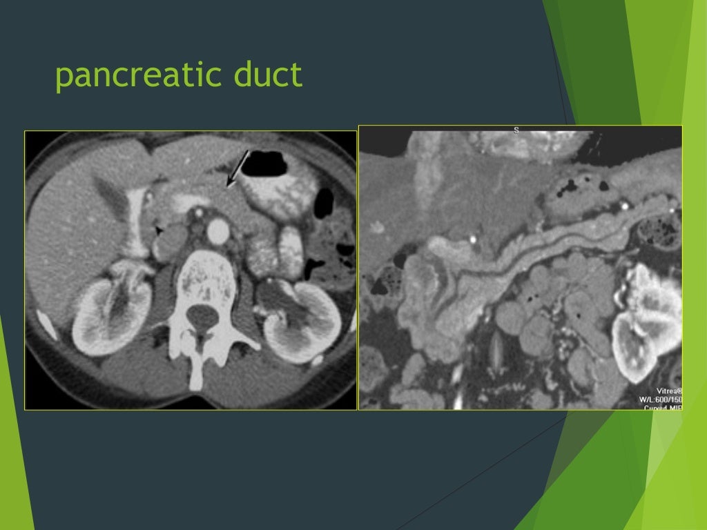 Imaging features of hepatobiliary and pancretic ds