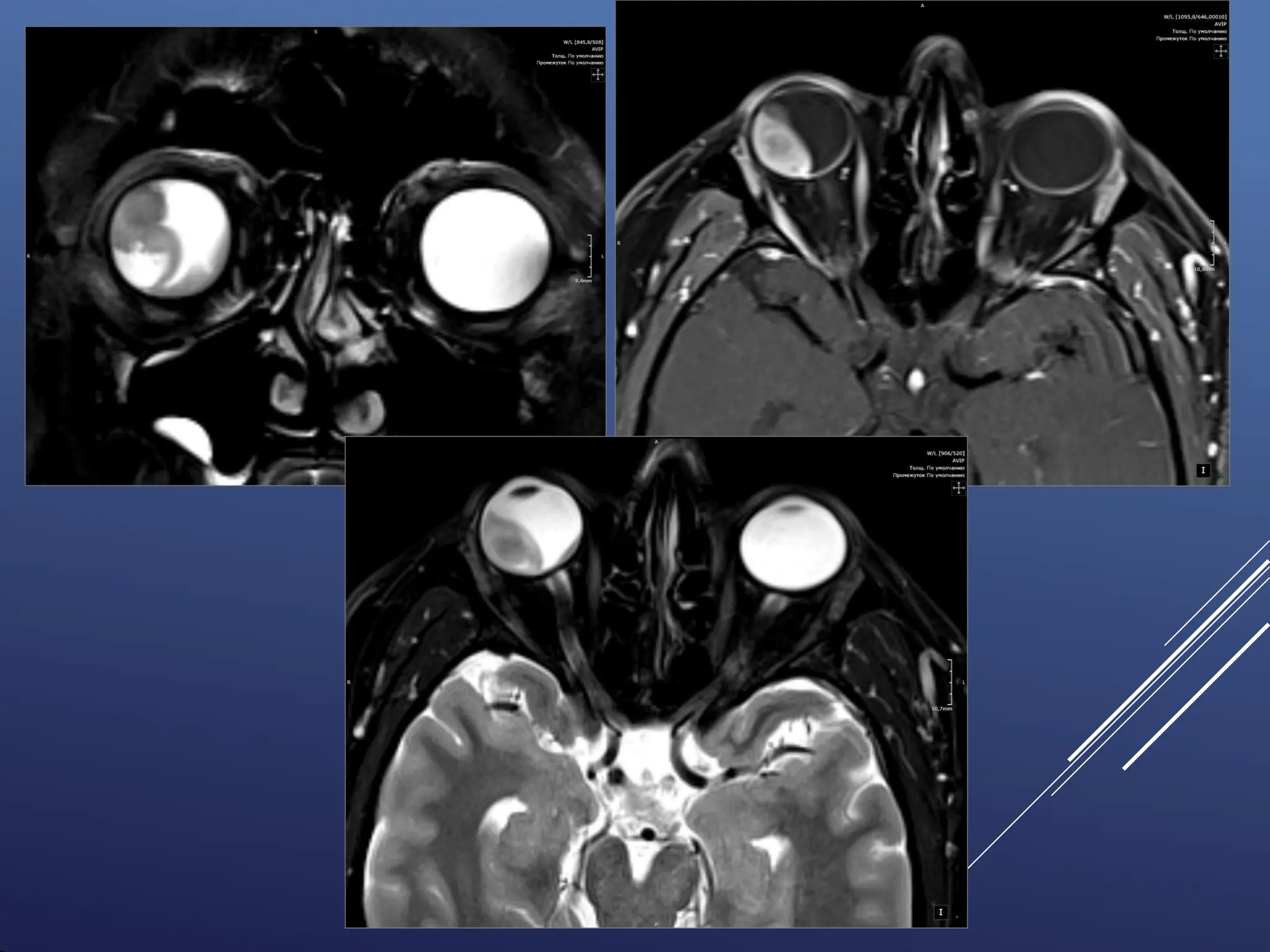Imaging-in-oftalmology radiology mbbs.pptx