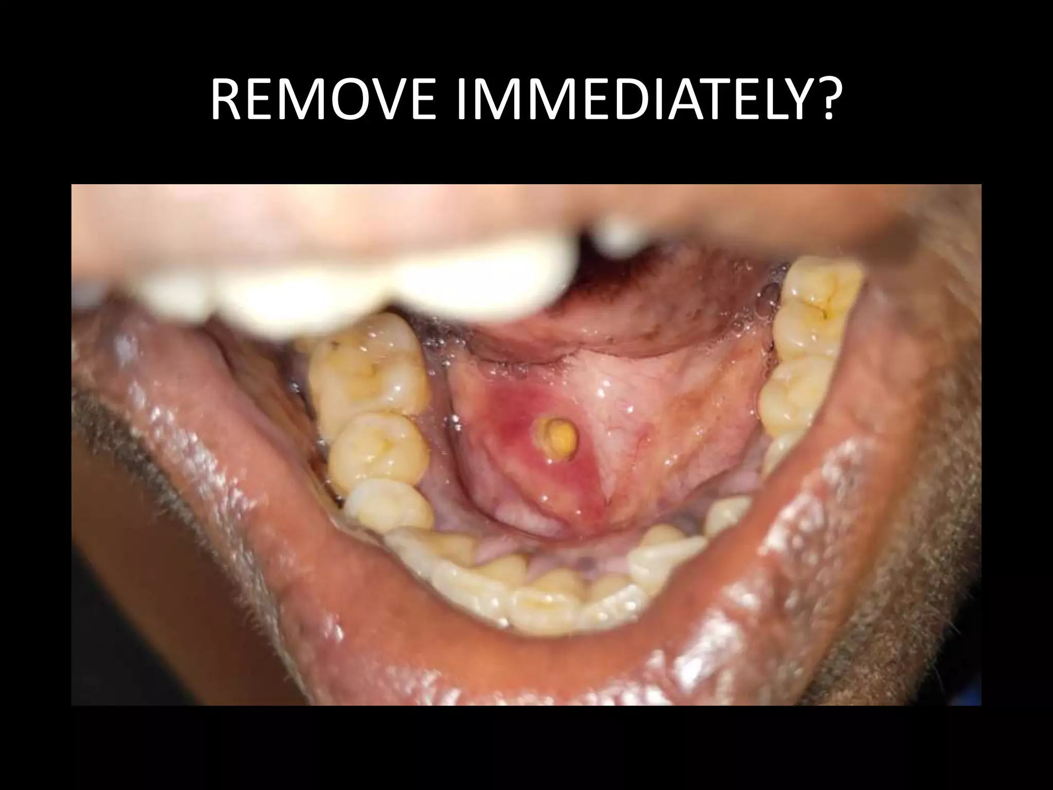 Imaging minor oral surgery | PPTX