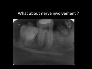 Imaging minor oral surgery | PPTX