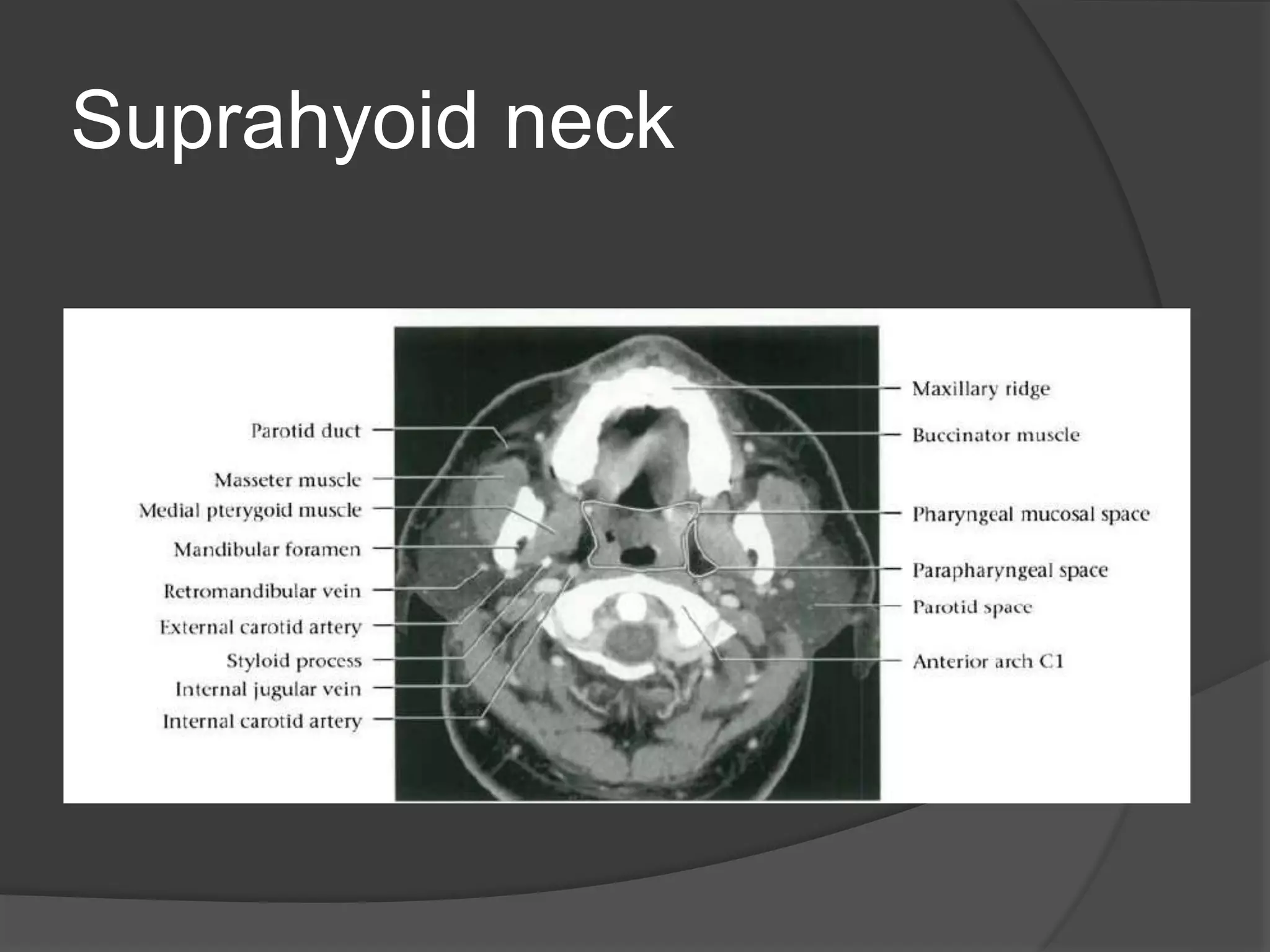 Imaging of the neck part i | PPTX