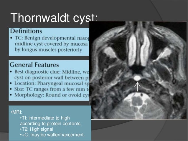 Imaging of the neck part ii