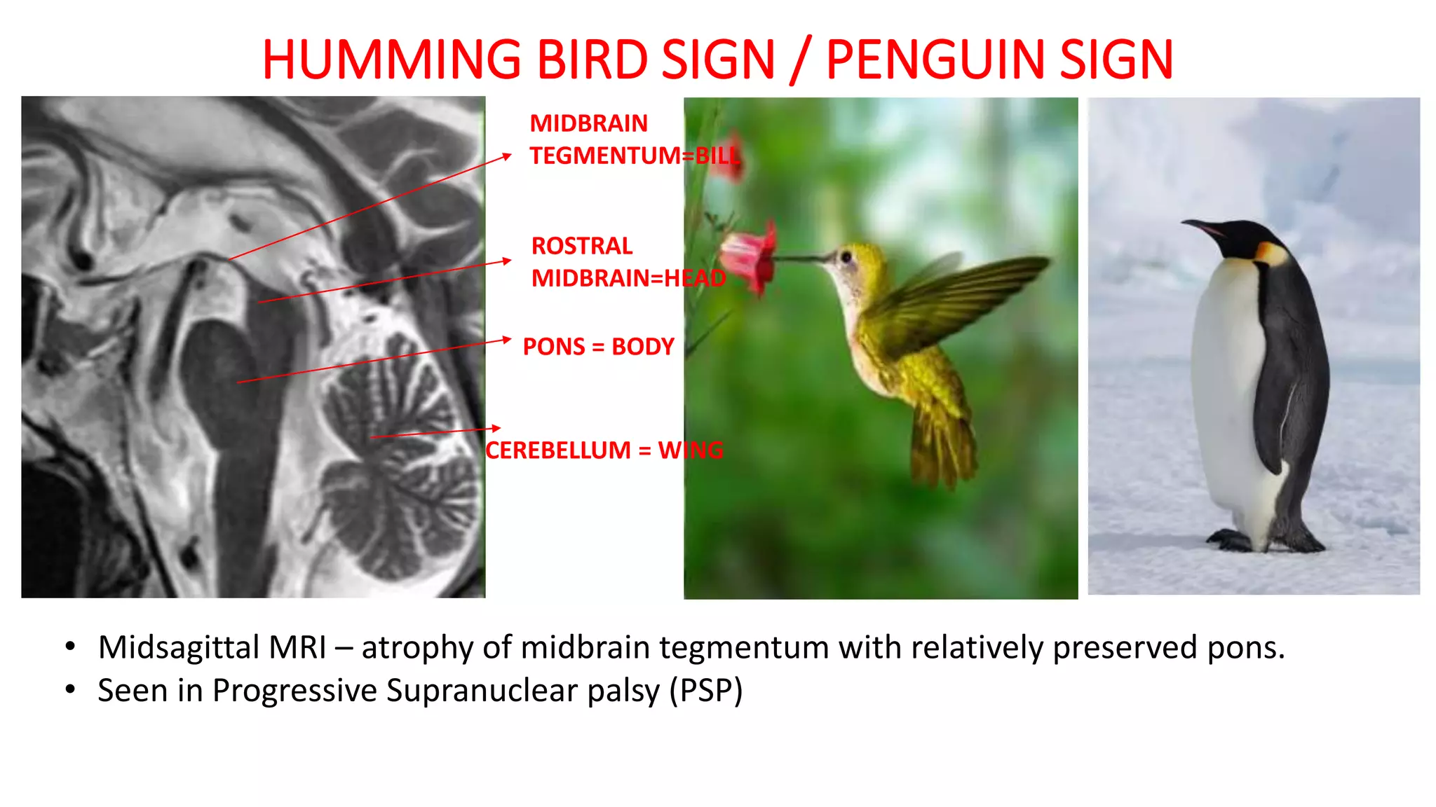 Imaging neurology spotters | PPTX