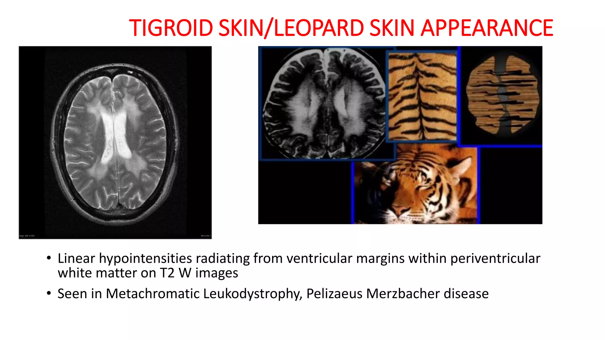 Imaging neurology spotters | PPTX