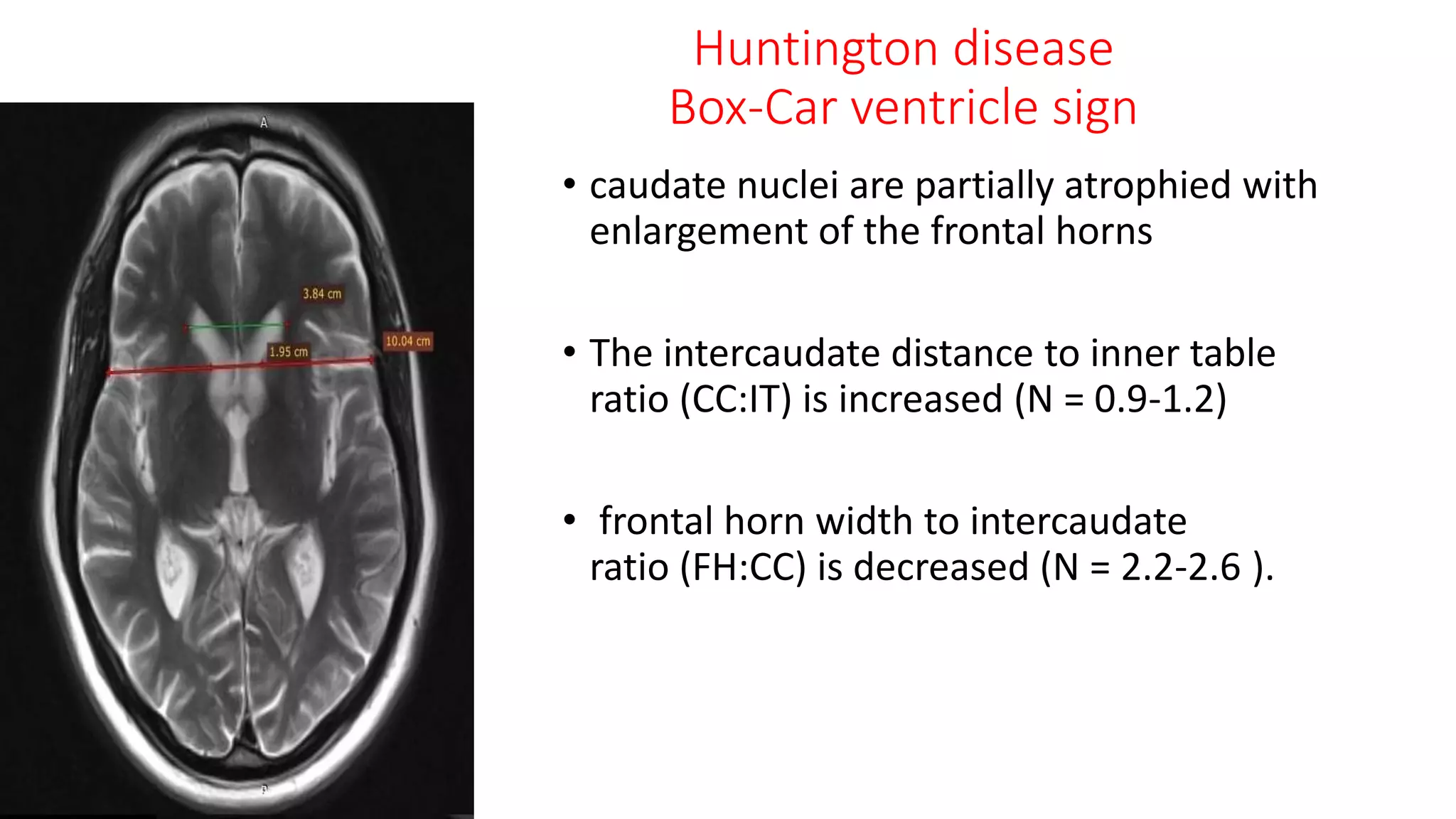 Imaging neurology spotters | PPTX