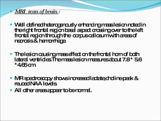 CT Scan: Glioblastoma Multiforme | PPT